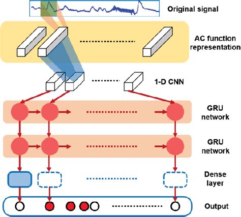 Figure 1 From Eeg Absence Seizure Detection With Autocorrelation