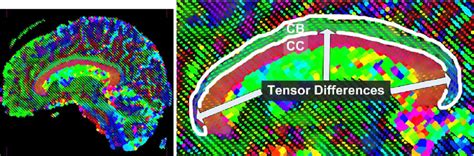 Example Of The Need For Local Constraints On Region Based Segmentation Download Scientific