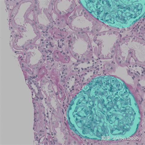 Openmmlab打卡笔记（7） Mmsegmentation代码教学 知乎