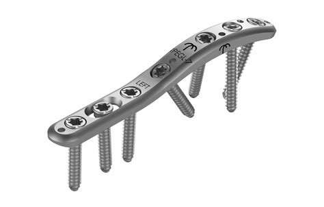 Radial Column Peg Plate Wrist Fracture Implant Trimed Inc