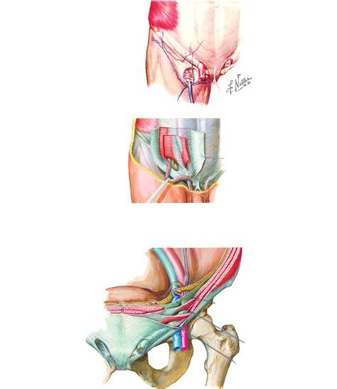 Inguinal Region