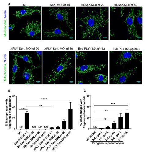 The Pore Forming Toxin Pneumolysin Is Not Essential To Trigger