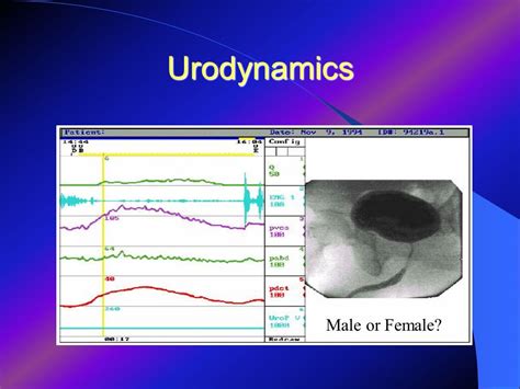 Evaluation And Treatment Of Urinary Incontinence And Prolapse Ppt Video Online Download