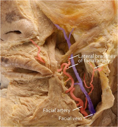 Facial Artery Cadaver