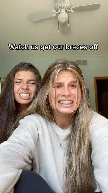 Braces Off