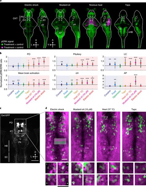 Brain Wide Responses To Noxious And Aversive Stimuli A Whole Brain Download Scientific Diagram