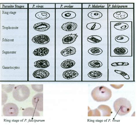 Plasmodium Falciparum Trophozoite