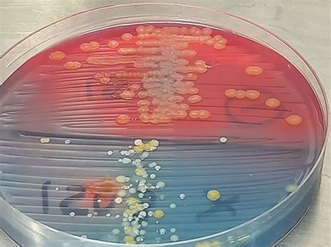 Citrobacter Farmeri Introduction Morphology Pathogenicity Lab Diagnosi