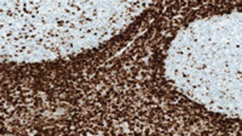 Optiview Amplification Kit