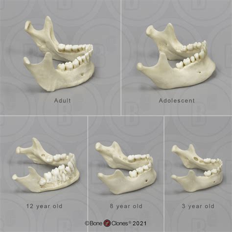Human Jawbone
