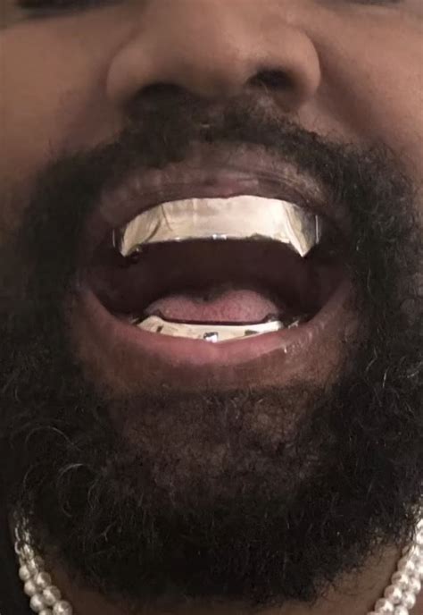Kanye West Debuts Us850k Titanium Teeth Reportedly Inspired By A James Bond Villain