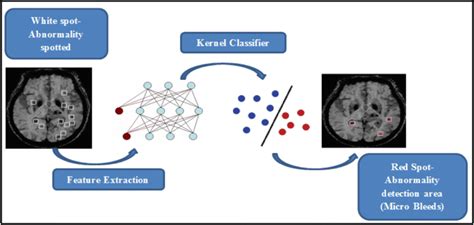 Cpp Ocnn Cerebral Micro Bleeds Image For Abnormality Detection