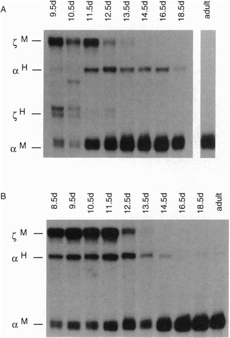 Expression Of Mouse M And Human H { And A Globin Mrna During