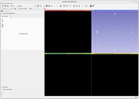 Exporting Urdf From Cad And Visualizing On Rviz And 3d Slicer Ros For