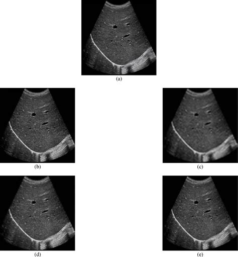figure 5 from design and implementation of speckle noise reduction