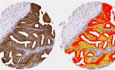 Tma Tissue Microarray Add On Indica Labs