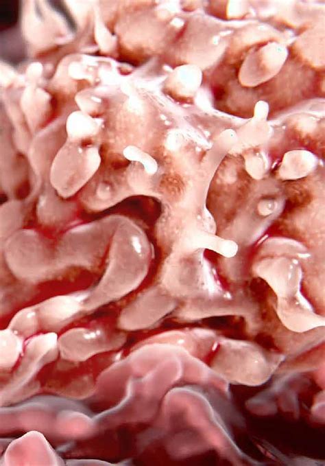 Advances In Bone Tissue Engineering Intechopen