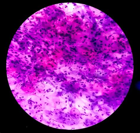 Human Cervix Cells Or Squamous Epithelial Cells Under Microscope To