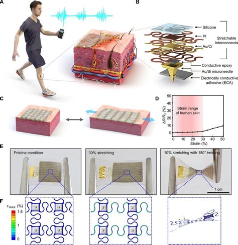 Sweat Resistant Wearable Robotic Sensors For Rehabilitation