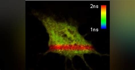 Picoquant Flim Upgrade Kit For Olympus Two Photon Confocal Microscope Laser Focus World
