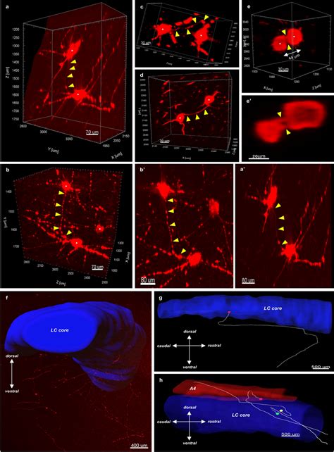 Potential Routes For Spreading Of Hyperphosphorylated Tau At8⁺cell