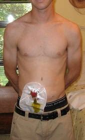 What Your Doctor May NOT Tell You About J Pouch Surgery Listen To Your Gut