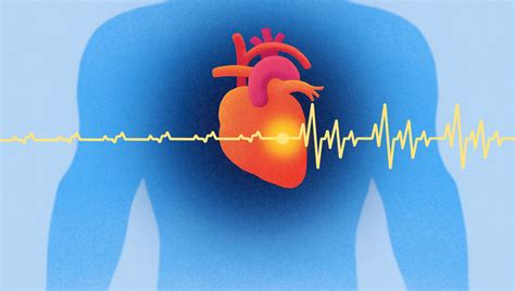 Atrial Fibrillation How The Ablation Can Be Done And To Whom It Is