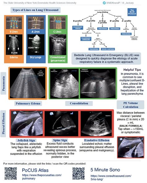 Icu Onepager On Twitter Cool Pocus Onepagers