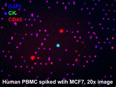 On Chip Ctc Staining Detection Sievewell™