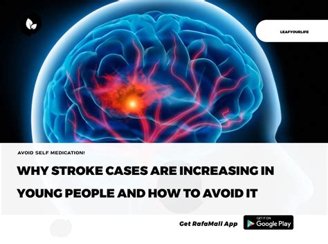 Why Stroke Cases Are Increasing In Young People And How To Avoid It