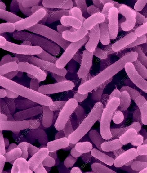 Agrobacterium Tumefaciens Sem Stock Image C0322378 Science