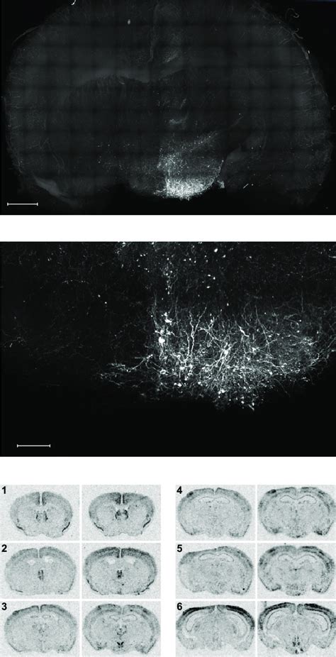 Anatomical Analysis Of Arc Pomc Neuronal Projections And The Extent Of Download Scientific