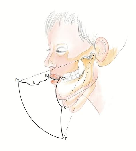 Dental Occlusion Geeky Medics