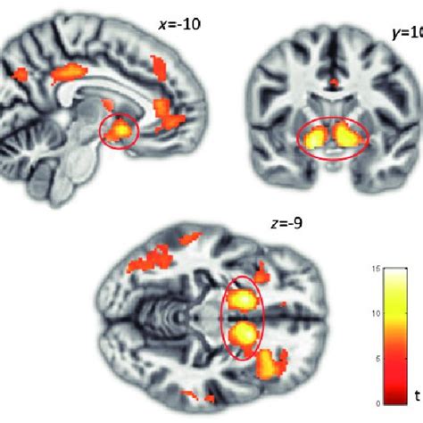 Reward Prediction Error Base Brain Regions Significantly Download Scientific Diagram