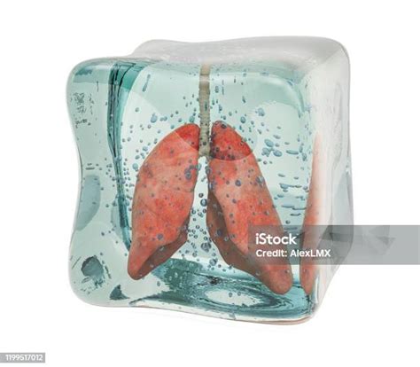 얼음 큐브에 얼어 붙은 인간의 폐 흰색 배경에 고립 된 3d 렌더링 냉동된에 대한 스톡 사진 및 기타 이미지 냉동된 폐