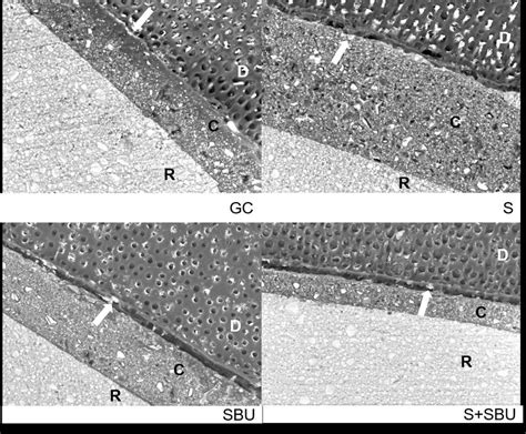 Photomicrograph Sem With 1000x Magnification Showing The Adhesive