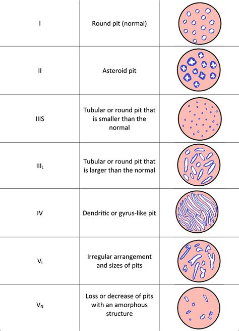 Endoscopic Recognition And Resection Of Malignant Colorectal Polyps Techniques And Innovations