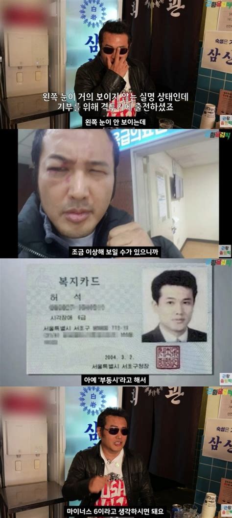 김보성 왼쪽 눈 실명오른쪽 시력도 마이너스 6