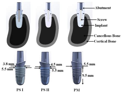 Computation Special Issue Application Of Finite Element Methods