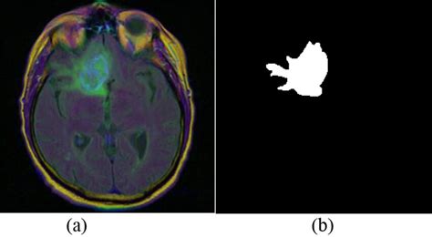 Details Of Dataset A Brain Mri Image B Manual Segmentation Mask