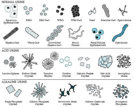 Urine Sediment Medical Laboratory Scientist Mls Facebook