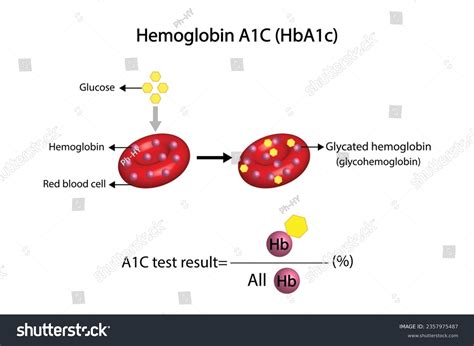 Hemoglobin A1c Hba1c Test Hba1c Levels เวกเตอร์สต็อก ปลอดค่าลิขสิทธิ์ 2357975487 Shutterstock
