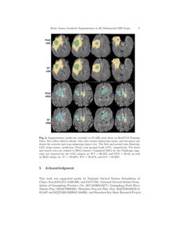 Brain Tumor Synthetic Segmentation In D Multimodal MRI Scans DeepAI
