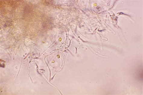 Chroococcus Turgidus Cf