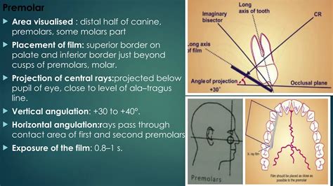 Bisecting Angle Technique Radiology Ppt Pptx
