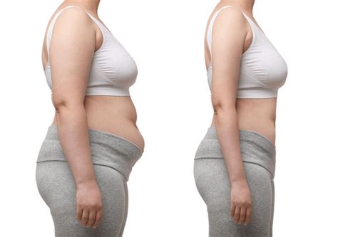 Before And After Diet Photos