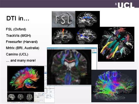 diffusion tensor imaging overview theory basic physics tensor