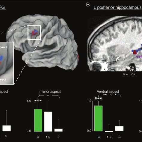 Condition Specific Subsequent Memory Effects Regions Showing