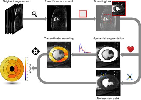 The Flow Chart Representing The Pipeline For Automated Myocardial Download Scientific Diagram