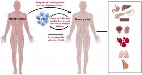 Research Progress Of γδt Cells In Tumor Immunotherapy Pmc